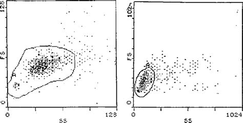 Apl Promyelocytes And Blast Cells Fw Sc Rt Sc Patterns Hypergranular