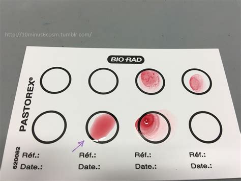 MICROCOSM Staphylococcus Pseudintermedius Formerly Known As