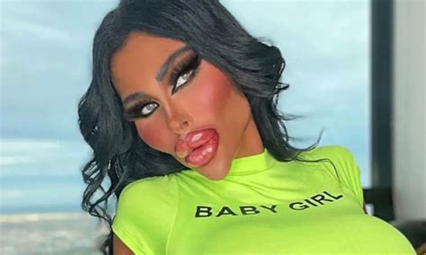 Human Barbie Spends 200k On 6 Nose Jobs And Dozens Of Other Surgeries