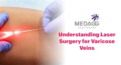 Is Sex Good For Enlarged Prostate Understanding Risks And Benefits