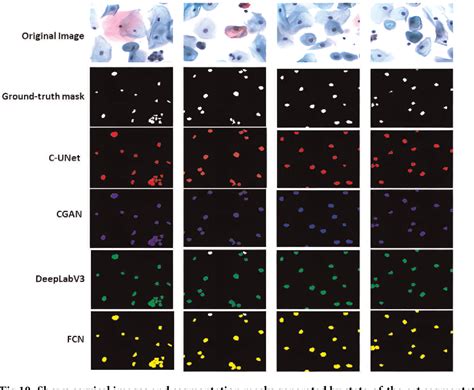 Figure 10 From Cervical Cells Nucleus Segmentation Through An Improved