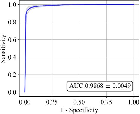 Figure 2 From Fully Automated Spike Detection And Dipole Analysis Of Epileptic Meg Using Deep