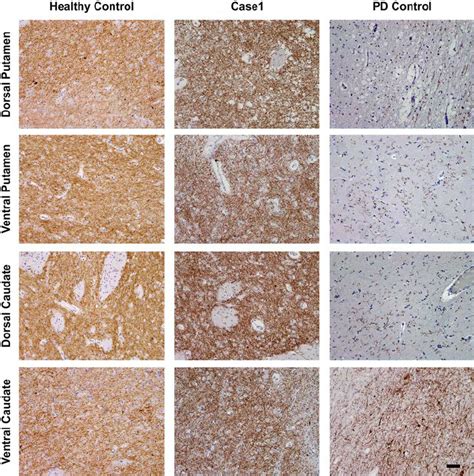 Tyrosine Hydroxylase Th Immunohistochemistry In Four Subregions Of
