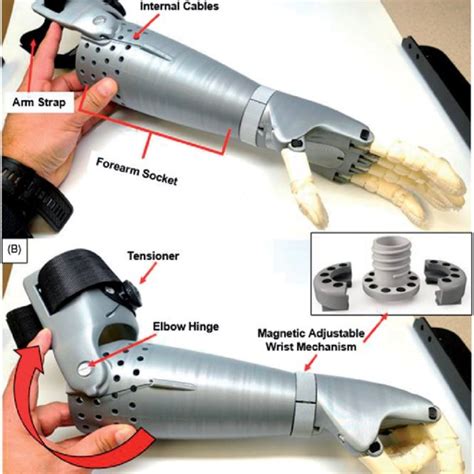 3 D Printed Elbow Driven Prostheses A Shows The Device In The Open Download Scientific