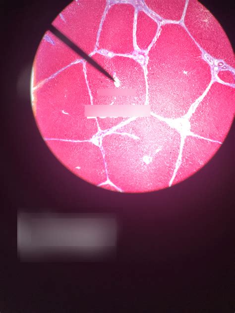 Slide Diagram Quizlet