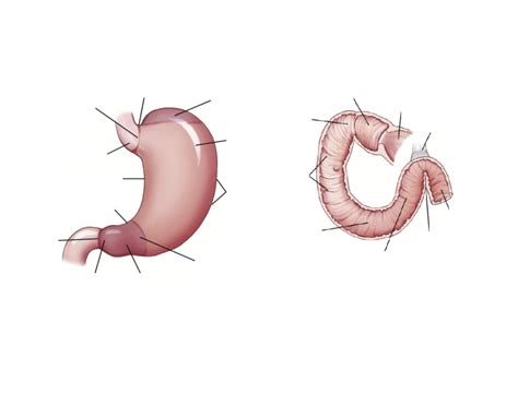Stomach And Duodenum Labeling Quiz