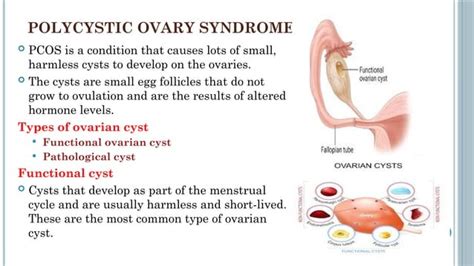 Uterine Anomalies Prolapse Ovarian Cyst Pptx