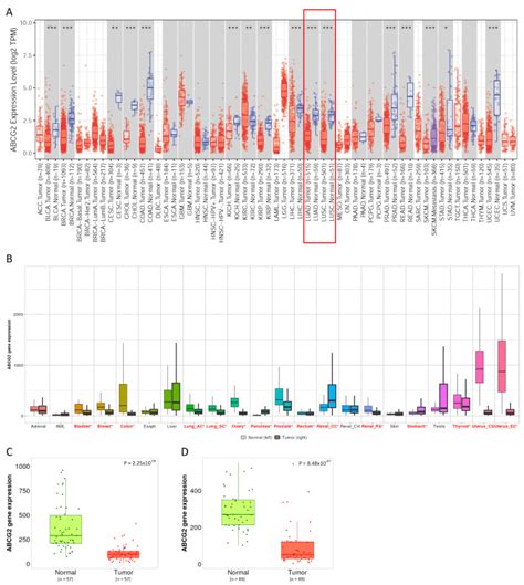 Abcg2 Gene Expression In Non Small Cell Lung Cancer Pmc