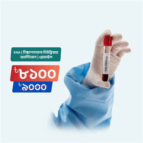 Book Ena Extractable Nuclear Antigen Profile Lab Test Online From