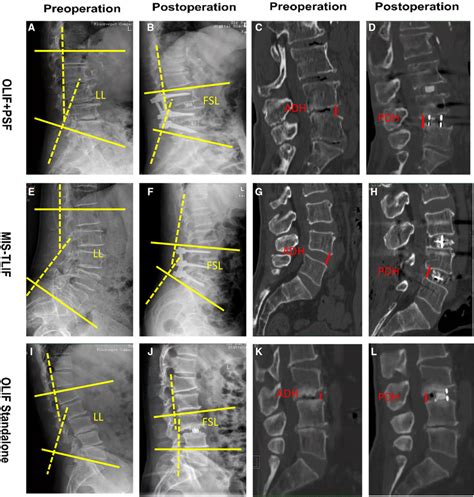 Schematic Diagram Of Pre And Post Operative Imaging Parameter