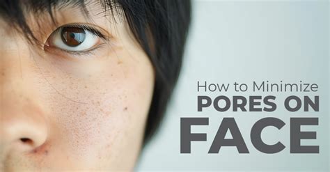 How To Minimize Pores On Face Causes And Ways To Shrink Them O Klinik Aesthetic