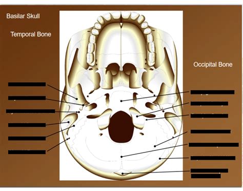 Basilar Skull Quiz