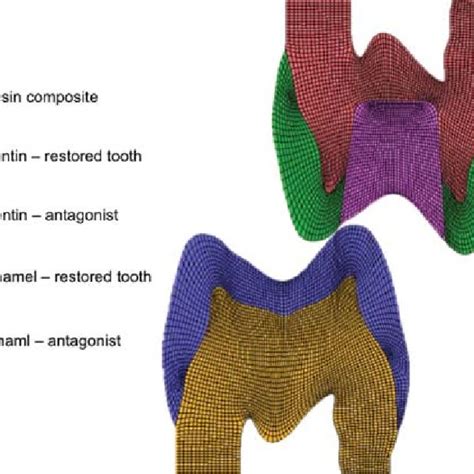 Finite Element Mesh Of The Digitized Premolar With Composite Download Scientific Diagram