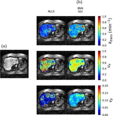 A Exemplary Slice Of The Dce Mr Data For A Patient With Hepatic Tumor