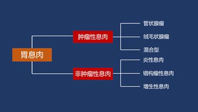 胃息肉会癌变吗？带你重新认识胃息肉 知乎