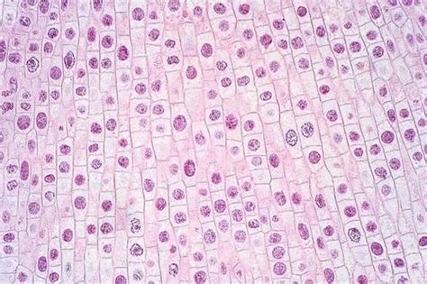 Glass Bms Mitosis In Plant Permanent Microscope Slide Thickness 1
