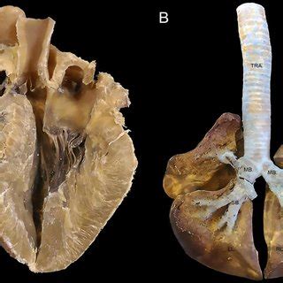 D Marsupialis Embryos A Lateral View B Ossification Process Of Download Scientific