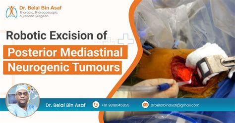 Difference Between Thoracotomy And Thoracostomy