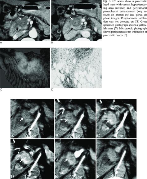Single Level Dynamic CT Scans Obtained Before A And 2 Seconds B 6 Download Scientific
