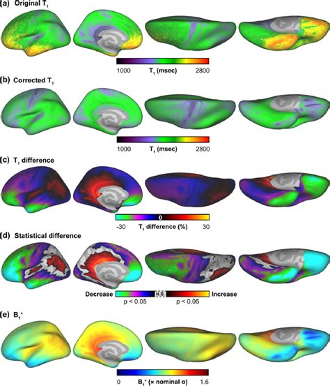 Fig Ure 3 Average Cortical T 1 Surface Maps Original A And Corrected Download Scientific
