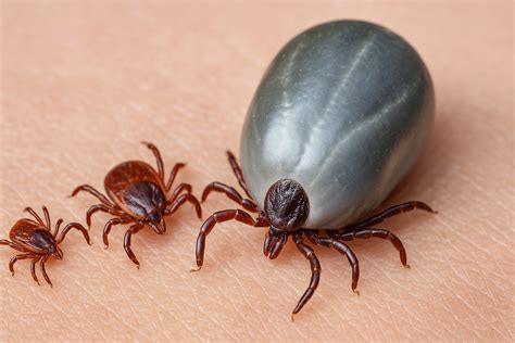 La Enfermedad De Lyme Junto Con El Síndrome Alfa Gal Y La Parálisis