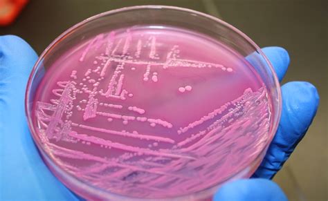 Coliforms Fecal Coliforms And Escherichia Coli E Coli