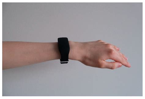 Assessing Parkinsons Rest Tremor From The Wrist With Accelerometry And Gyroscope Signals In