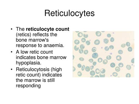 Ppt Anaemia That Isnt Due To Iron Deficiency Powerpoint Presentation Id 658129