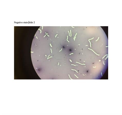 Solved Experiment 1 Simple Stain Using The Photos Provided Chegg Com