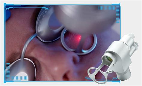 Multi Mode Vs Single Mode Laser What Is The Difference