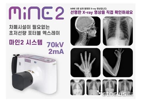 2023 광주 메디헬스산업전 오톰 초저선량 포터블 엑스레이 제품 전시 전자신문