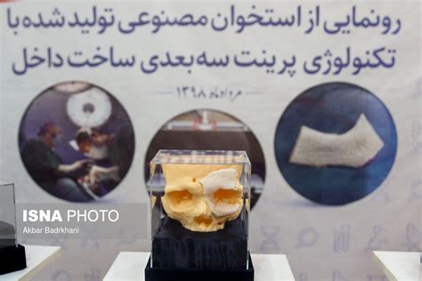 ISNA Iranian Researchers Develop Synthetic Bones Using D Printing