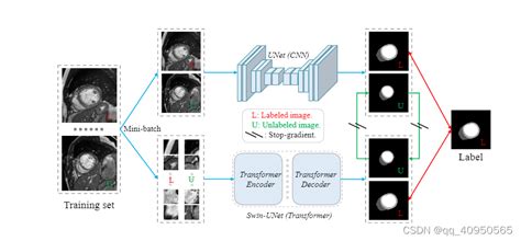 半监督分割与transformer结合论文阅读（更新中） semi supervised medical image segmentation
