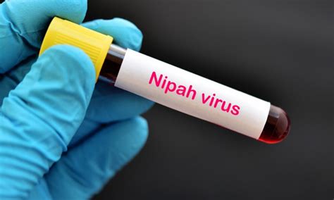 Nipah Virus Takes Two Lives In India Over 700 People Tested Sri