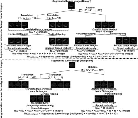 Augmentation Scheme Applied To Benign And Malignant Segmented Tumor Download Scientific Diagram