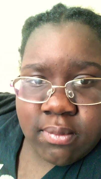 Lets See How Oiled My Forhead Is Youtube