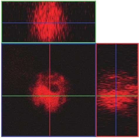 Orthogonal Confocal Projection Through An Unfixed Apoptotic Cell Download Scientific Diagram