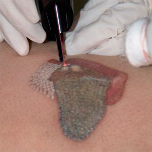 How Scanning Electron Microscopes Work HowStuffWorks