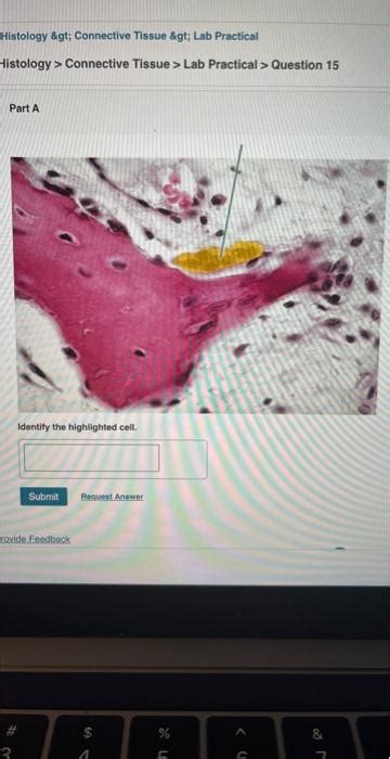 Solved Histology Connective Tissue Lab Practical Chegg