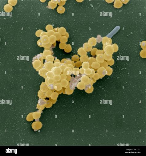 Staphylococcus Aureus Bacteria Coloured Scanning Electron Micrograph Sem These Gram Positive