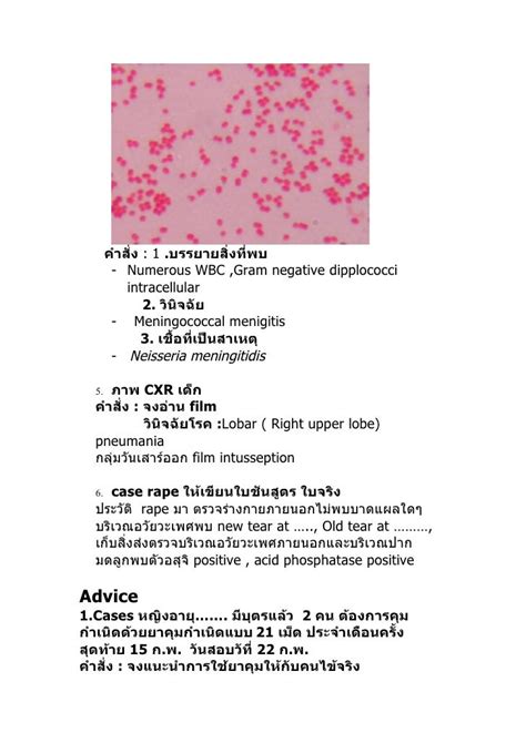 Example Osce