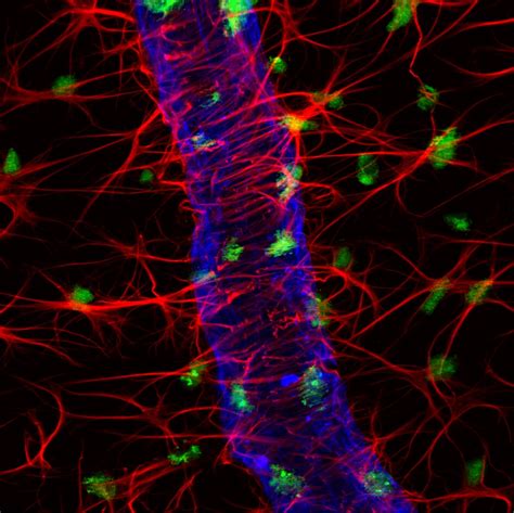An Introduction To Expansion Microscopy