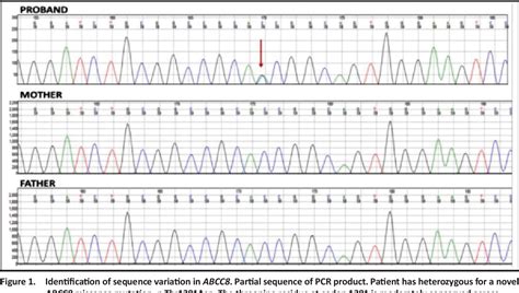 Figure 1 From A Novel De Novo Mutation At The Abcc8 Gene In A Newborn