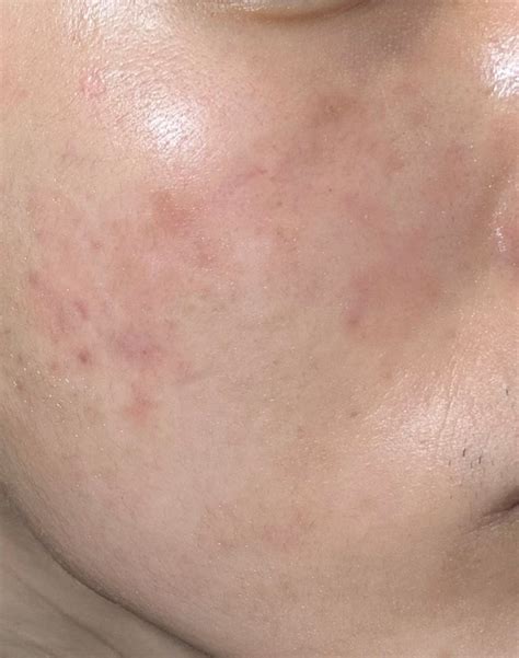 얼굴 피부가 이상해요 ㅜ 지식in