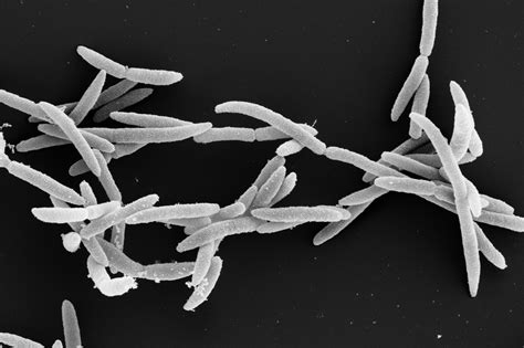 Hzi Cultured Mini Organs Reveal The Weapons Of Aggressive Bacteria