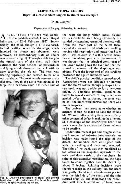 Cervical Ectopia Cordis Report Of A Case In Which Surgical Treatment