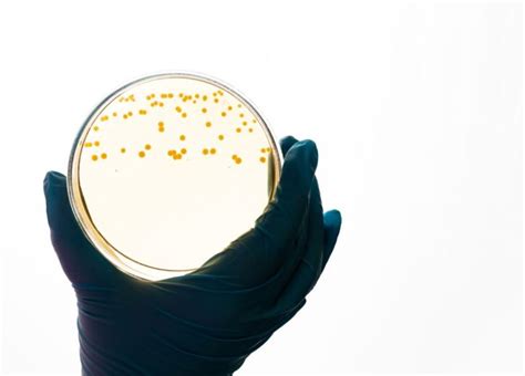 Diastaticus Yeast Infection In Beer Diastaticus Yeast Infection In Beer