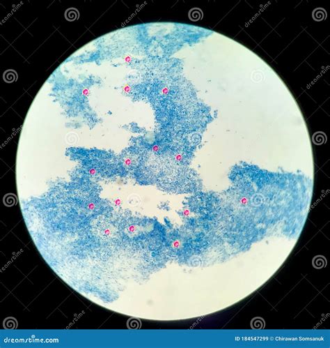 Red Cell On Blue Background Cryptococcus In Hiv Patients Stock Image Image Of Encapsulated
