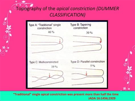 Working Length Determination Ppt Dental Health Diseases And Conditions