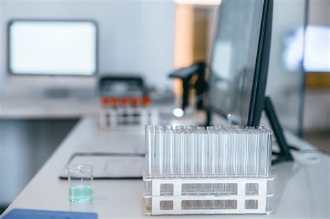 백신을 테스트하고 개발하기 위해 실험실 테이블에 의료 과학 및 연구 장비 사무실 작업장 책상에 유리 시험관 비커 및 화학 물질이